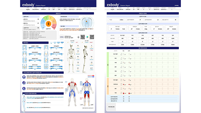 9100 - 엑스바디 exbody | 근골격&체형 분석 시스템 1위