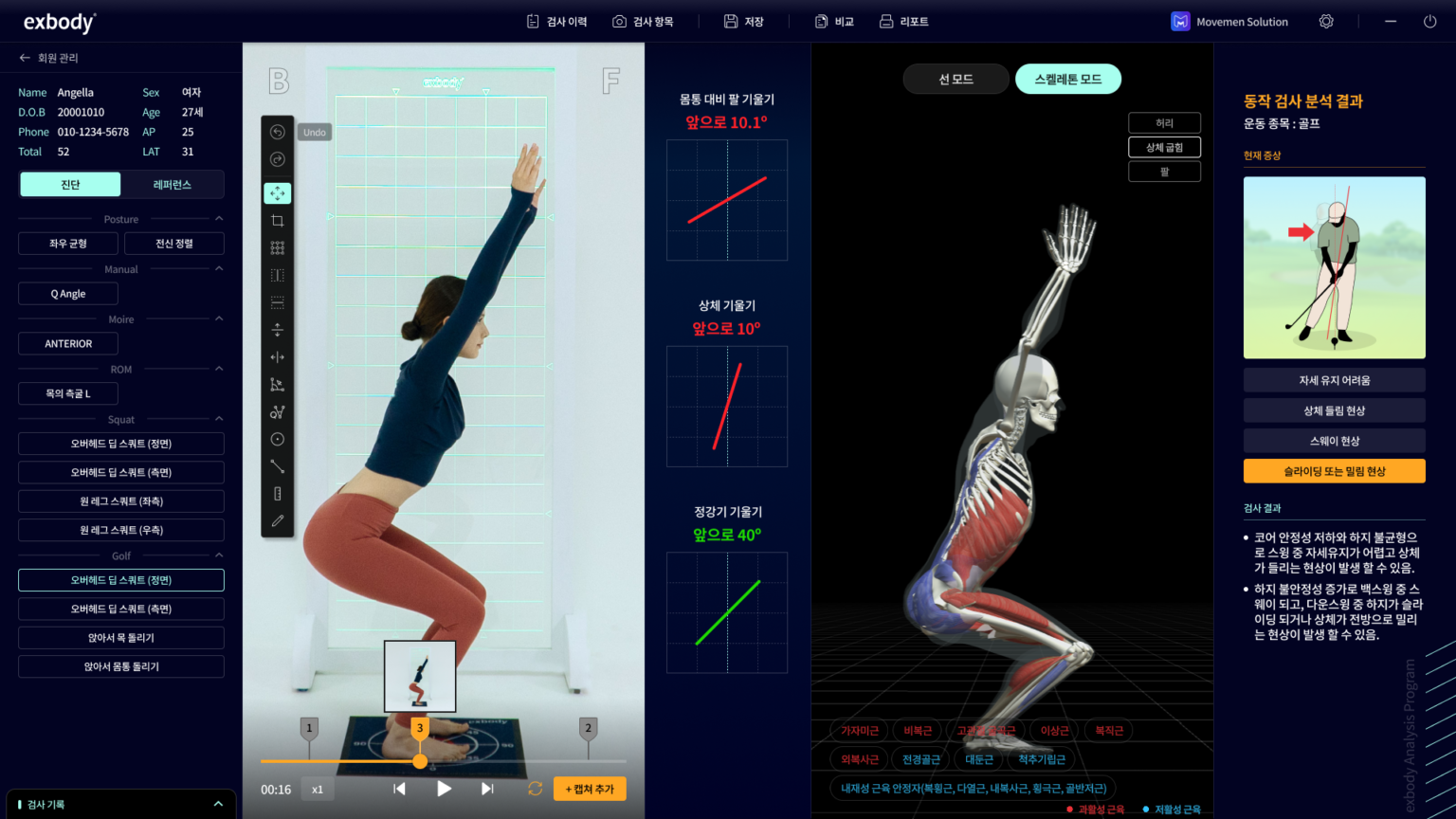 Exbodyt370 높낮이 조절 가능한 이동형 모델 엑스바디 Exbody 근골격and체형 분석 시스템 1위